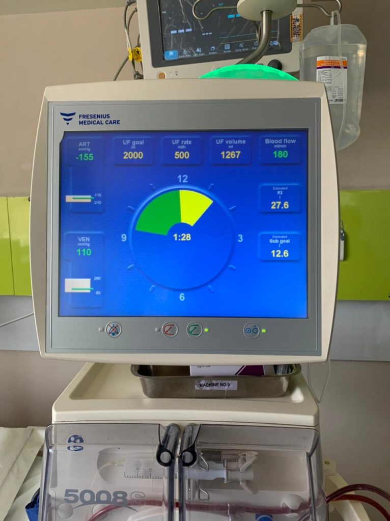 All you need to know about Online Hemodiafiltration (OL-HDF)