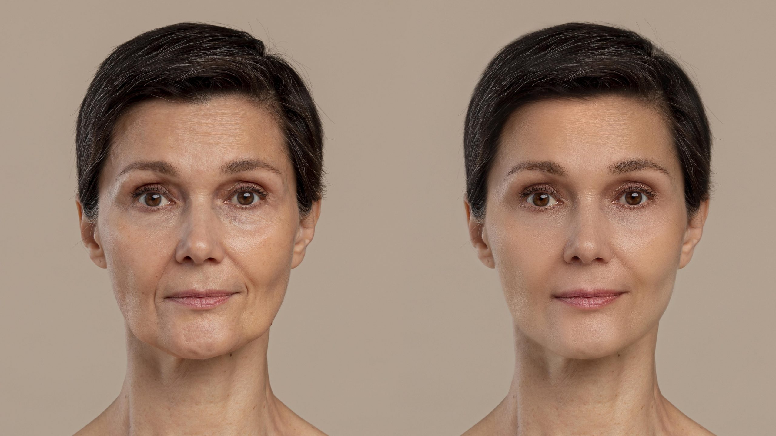 Contouring