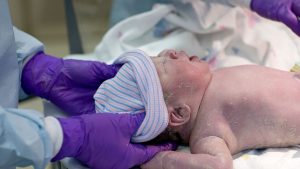 Blue Baby Syndrome: Symptoms, Causes & Treatment